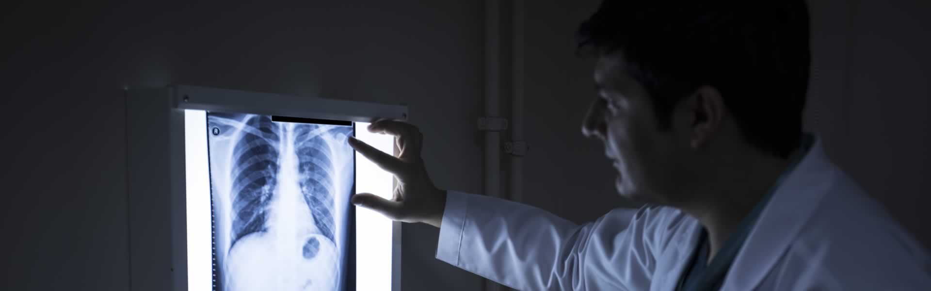 Virginia Lung Cancer Lawyer | The Law Offices of Peter T. Nicholl